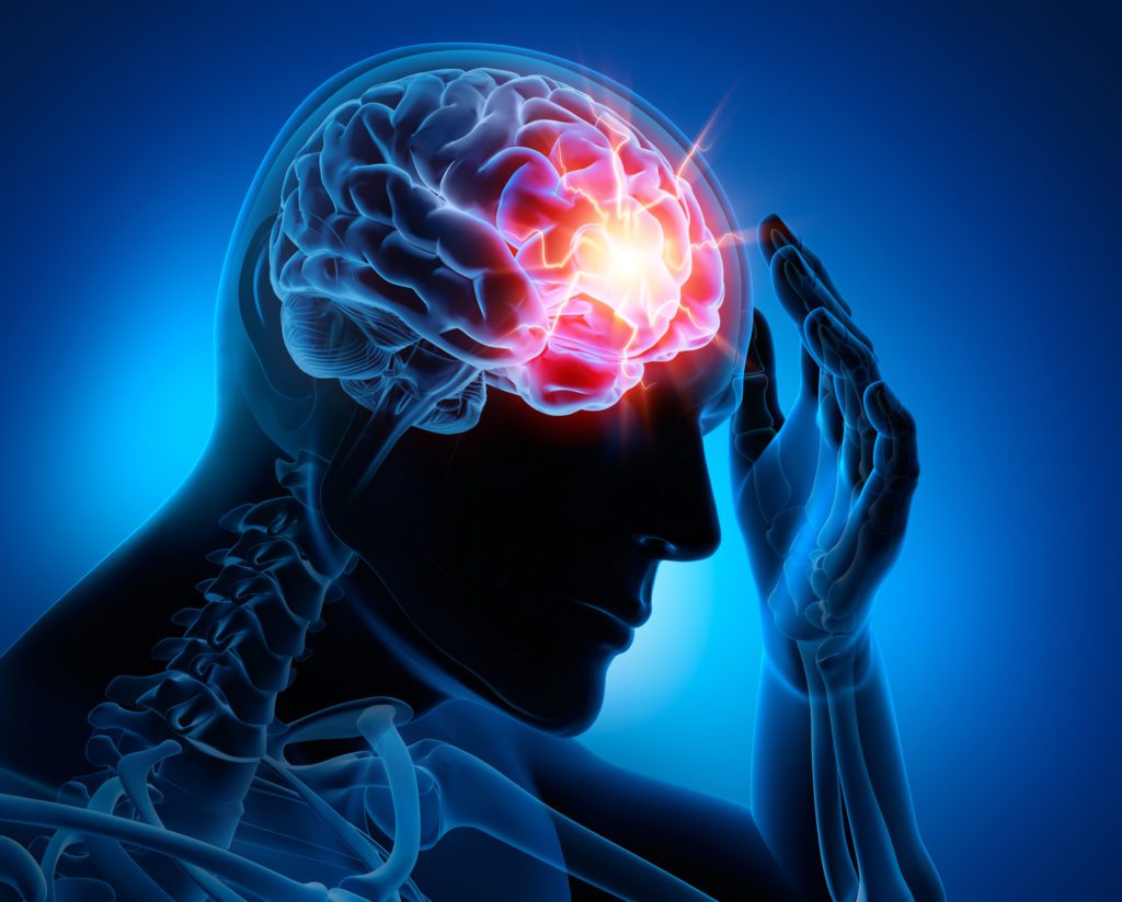Concussion Injury - Bradley Law Personal Injury Lawyers